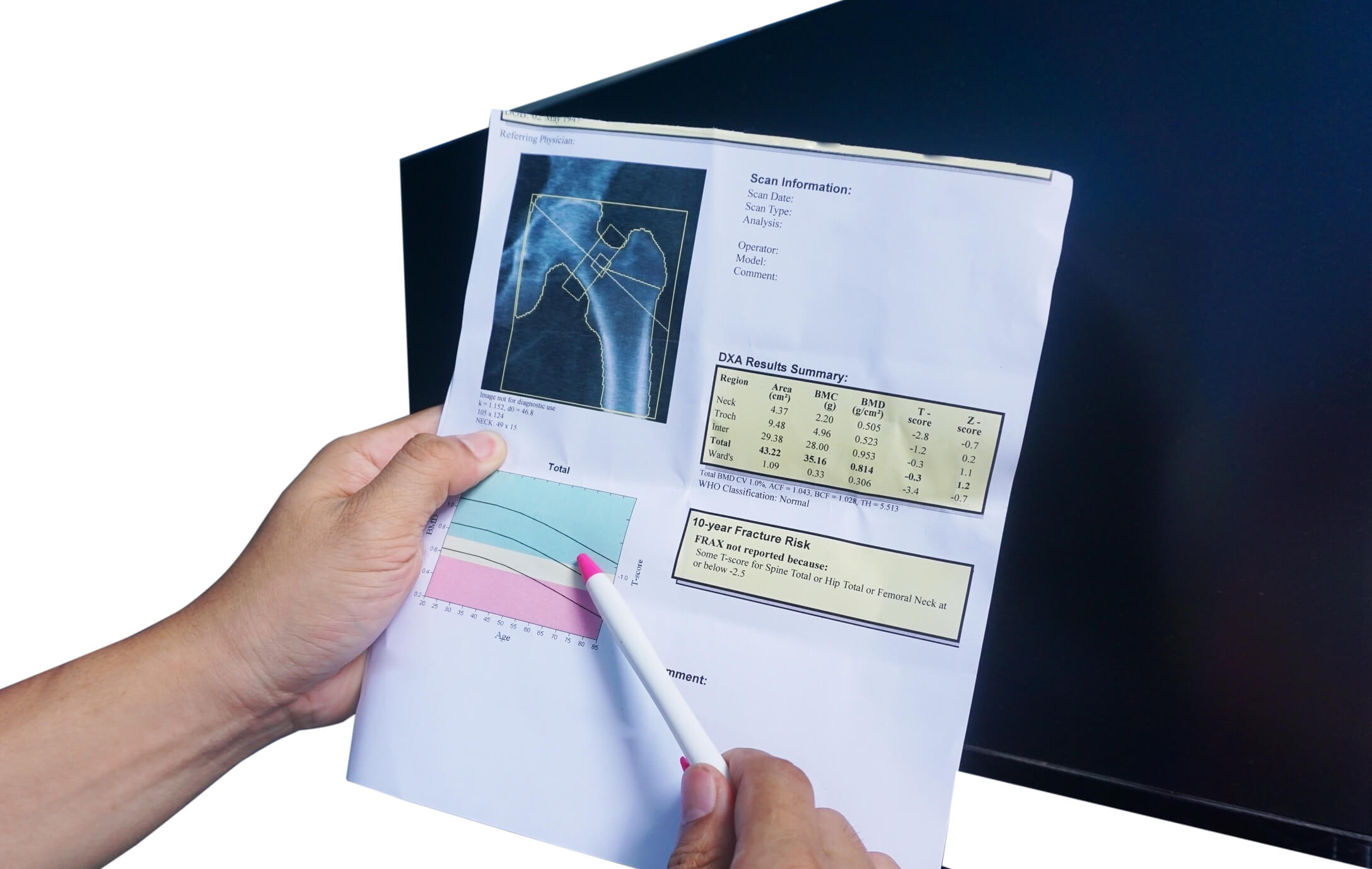 What are Dexa Scans?
